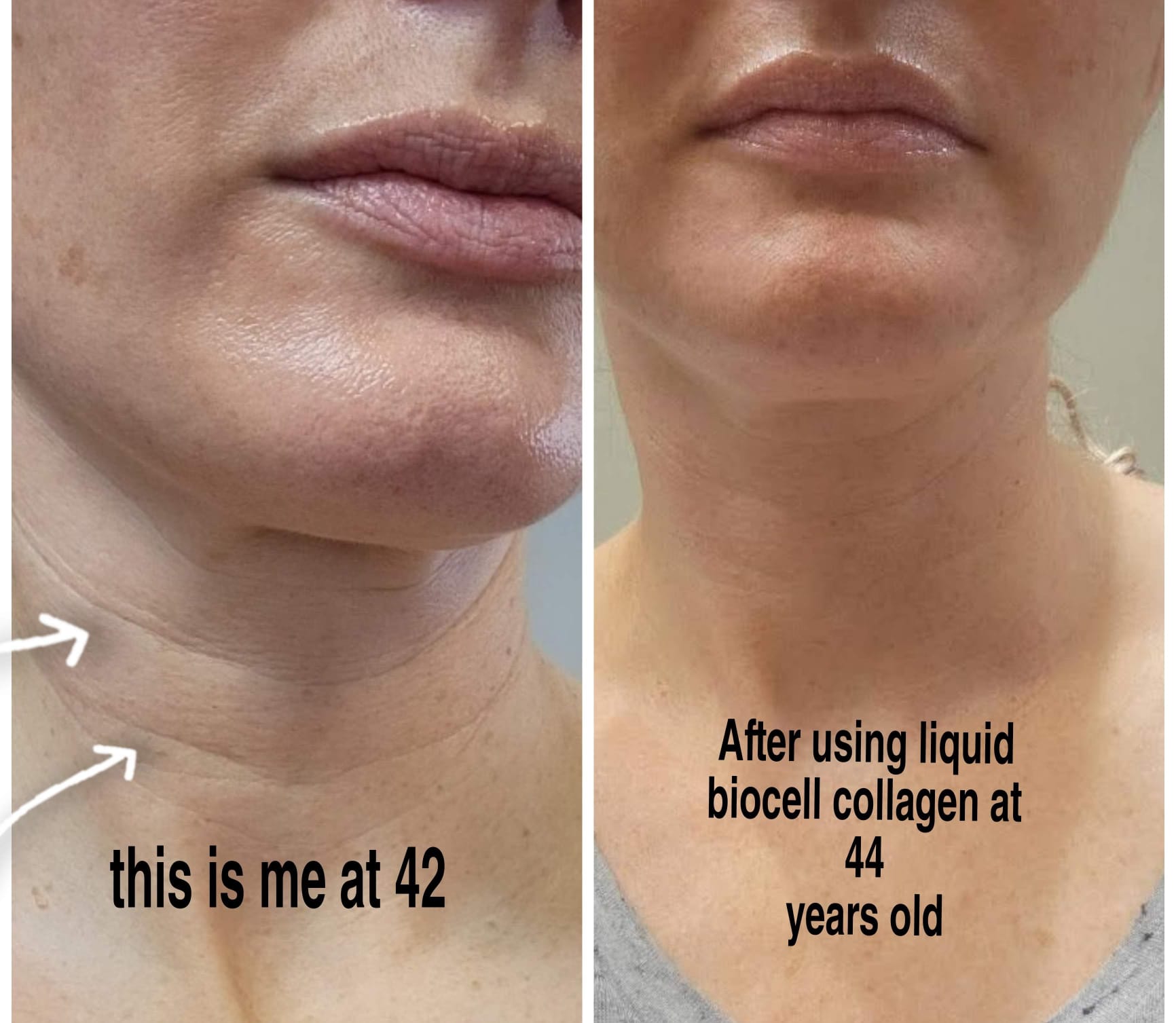 Liquid Biocell Collagen/HA